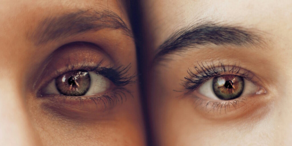 Eyelashes Growing Inwards? Here’s Why & What to Do