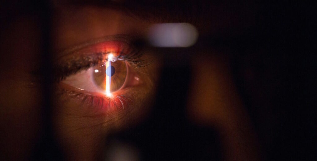 Eyelashes Growing Inwards? Here’s Why & What to Do